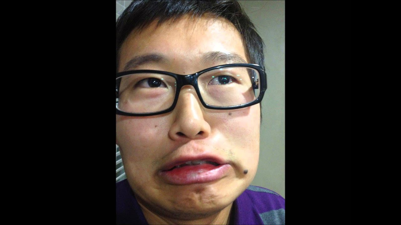 Dennis Rap wmp - YouTube