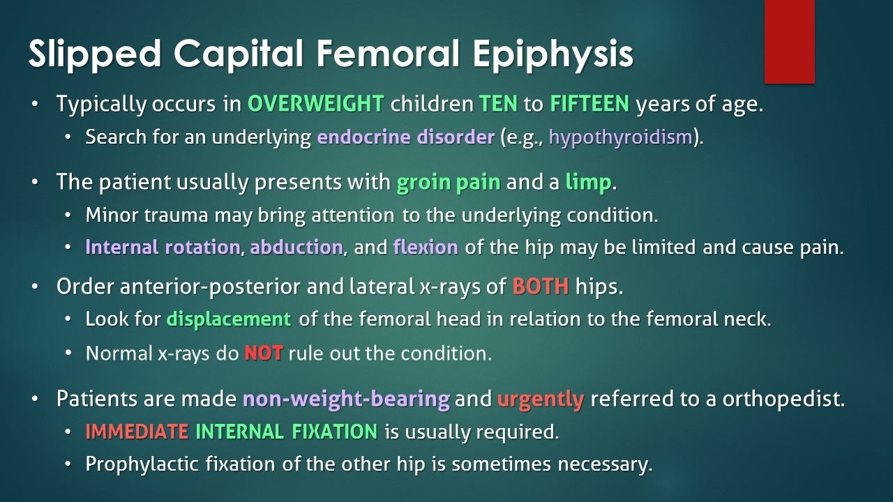 Slipped Capital Femoral Epiphysis - YouTube