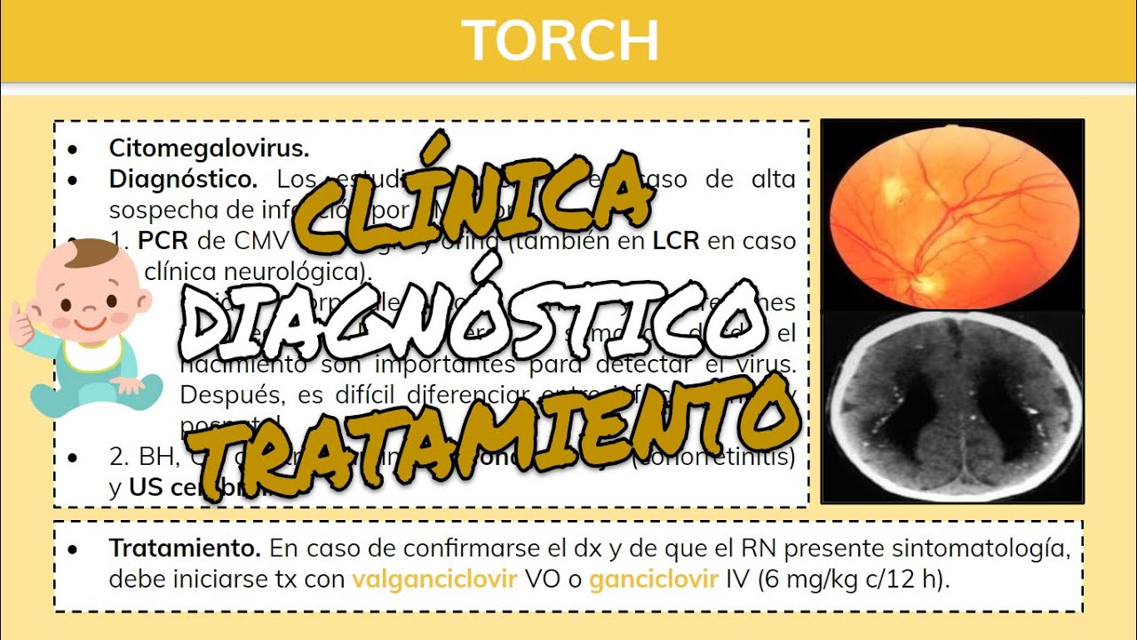 ⚕️🩺 Infecciones Congénitas TORCH (RUBEOLA, CITOMEGALOVIRUS, HERPES ...