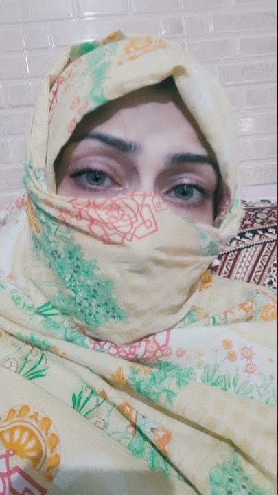 Remove freckles at home / Chaiyon ka ilaj - YouTube