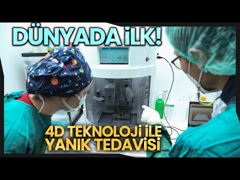 Yanık Tedavisinde Dünyada Bir İlk: Türkiye’de Uygulanıyor