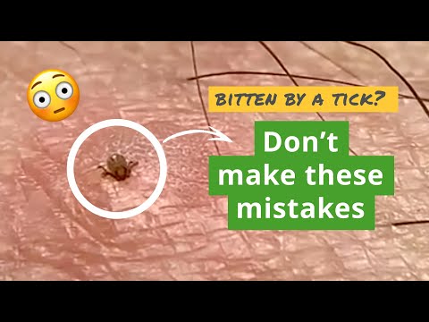 How To Get Rid Of Small Red Ticks