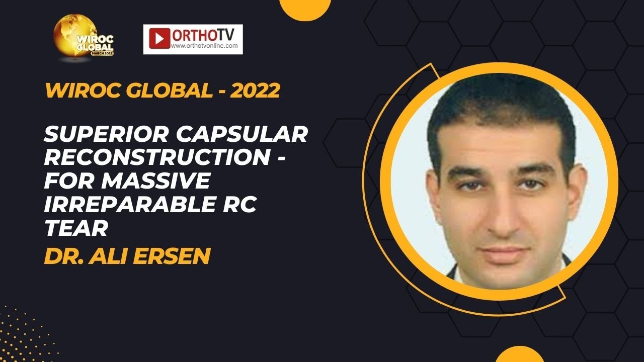 Wiroc Global 2022:SUPERIOR CAPSULAR RECONSTRUCTION - FOR MASSIVE IRREPARABLE RC TEAR - DR. Ali ...