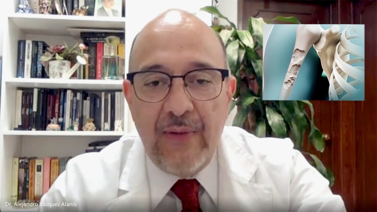 Dr. Alejandro Vázquez Alanis - Un café con el experto - YouTube