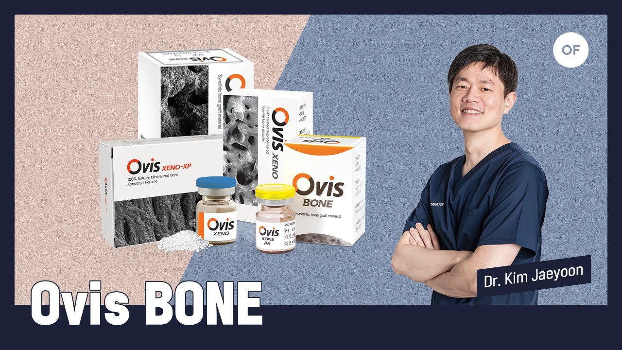 임상에서 덴티스를 더 잘 적용하기 위한 l Clinical applications with Ovis Bone - YouTube