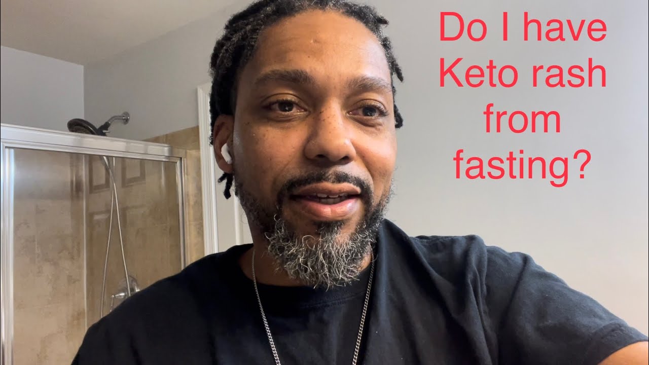 Do I have Keto rash from fasting? - YouTube