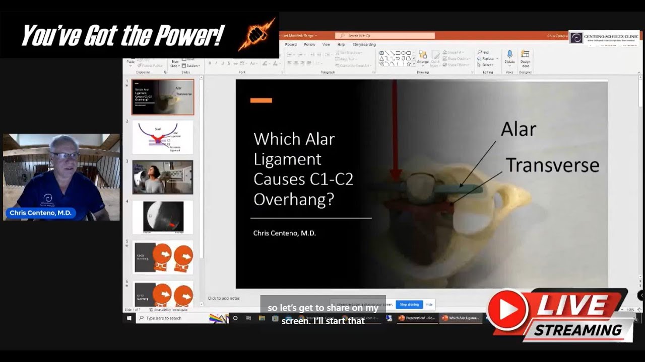 Which Alar Ligament is Responsible for C1-C2 Overhang? - YouTube
