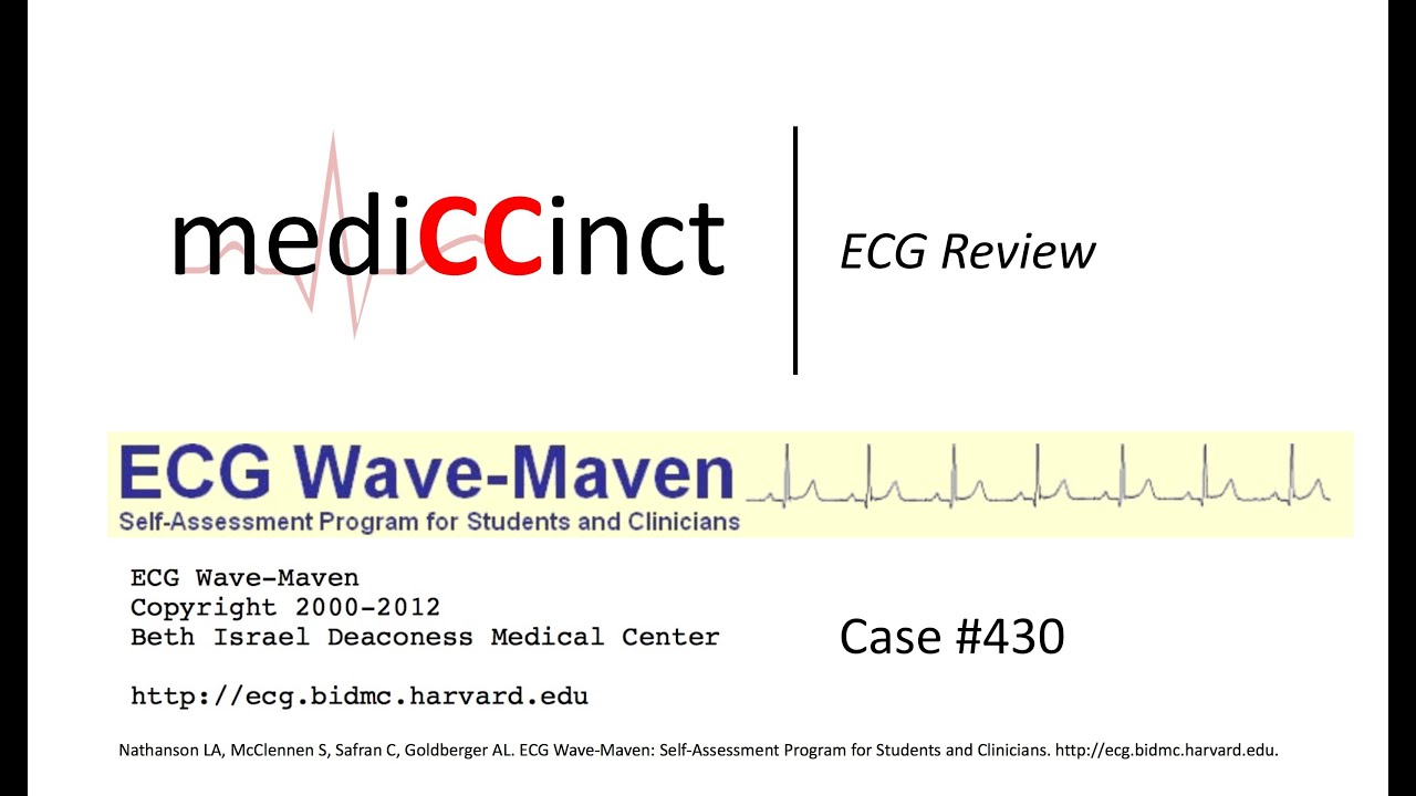 Cerebellar Hemorrhage (ECG Wave-Maven) Case #430 - YouTube