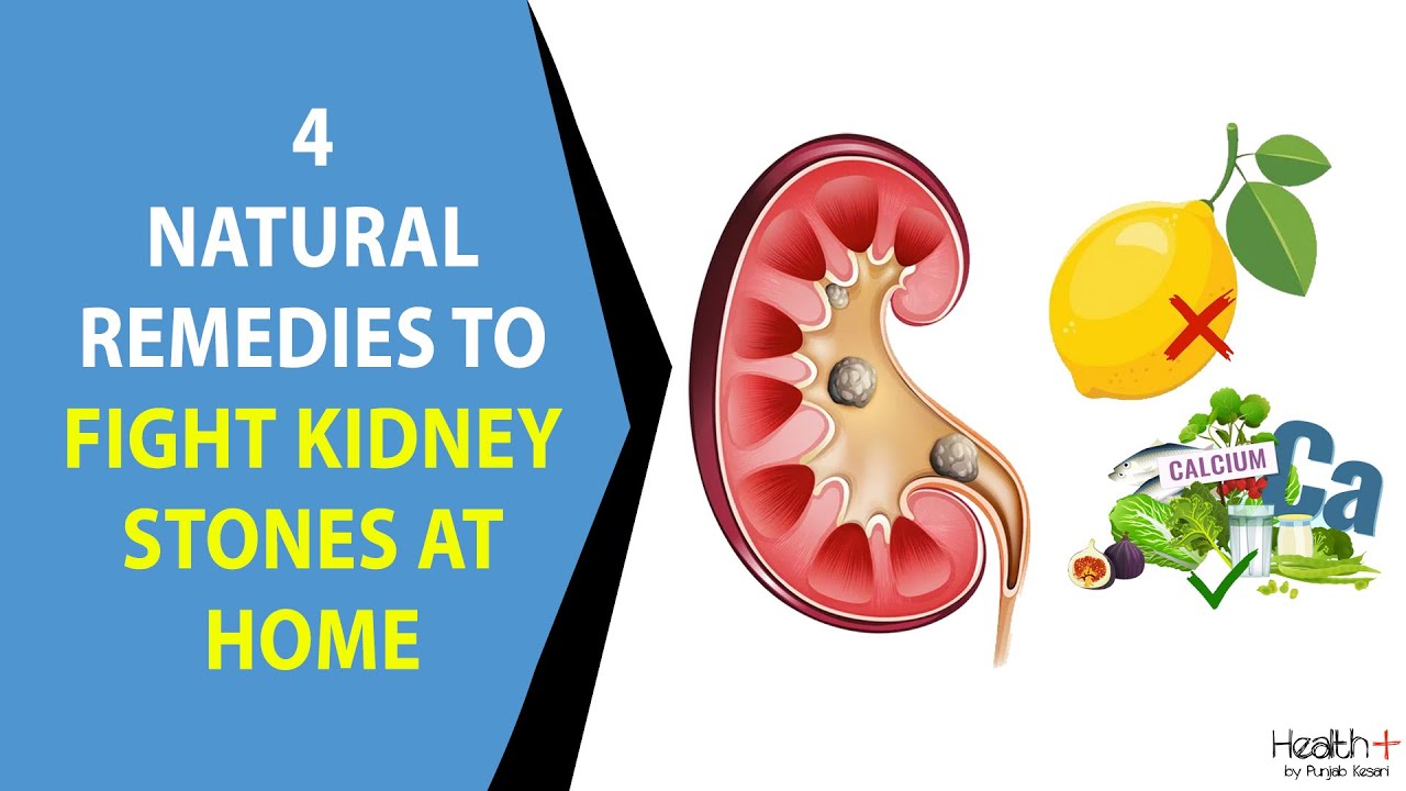 4 Natural Remedies to Fight Kidney Stones at Home - YouTube
