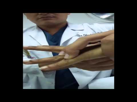 Maniobra de bouvier - YouTube