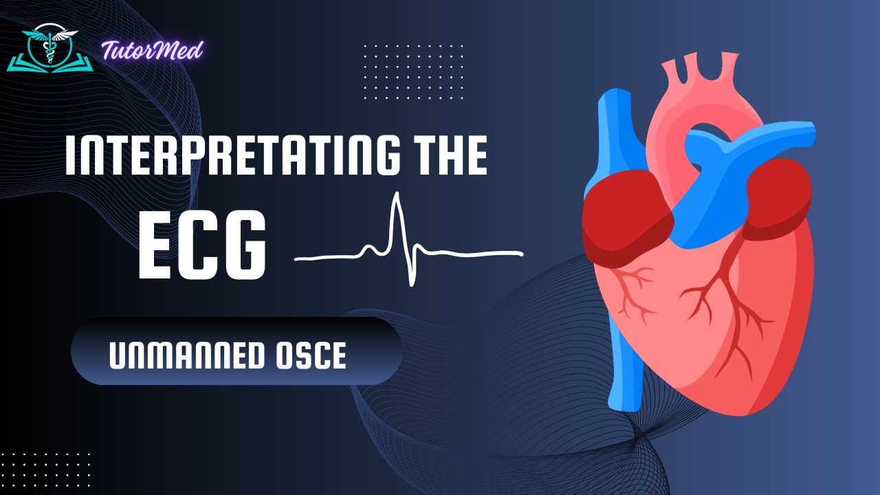 How To Answer ECG Questions in Unmanned OSCE | #GMDCExam | Steps to ECG ...