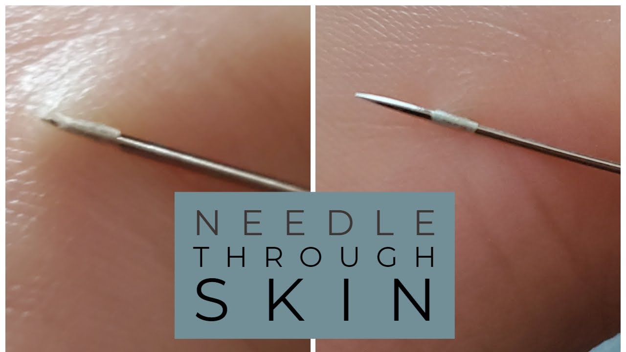 Needle through skin - YouTube