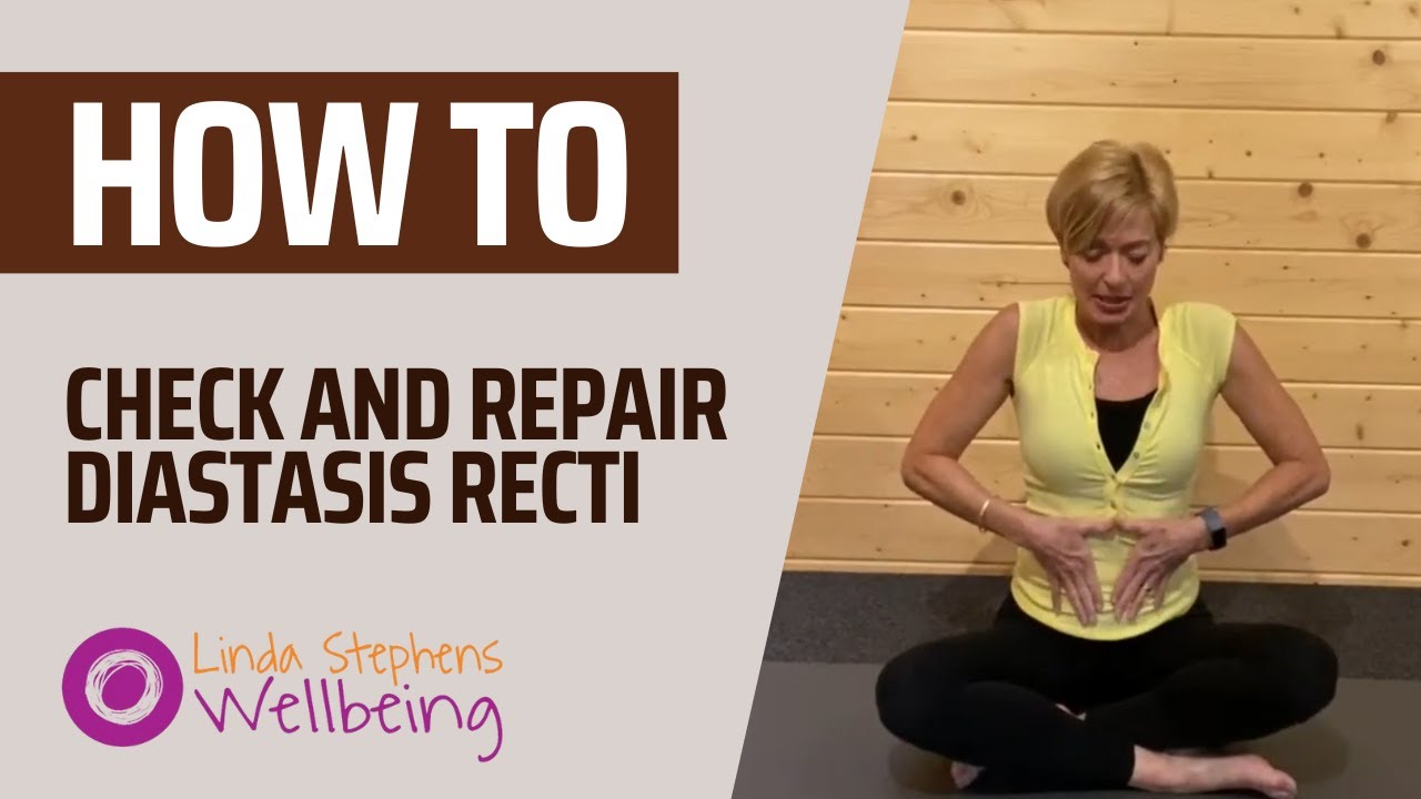 Check for Diastasis Recti, tummy muscle split (and basic repair ...