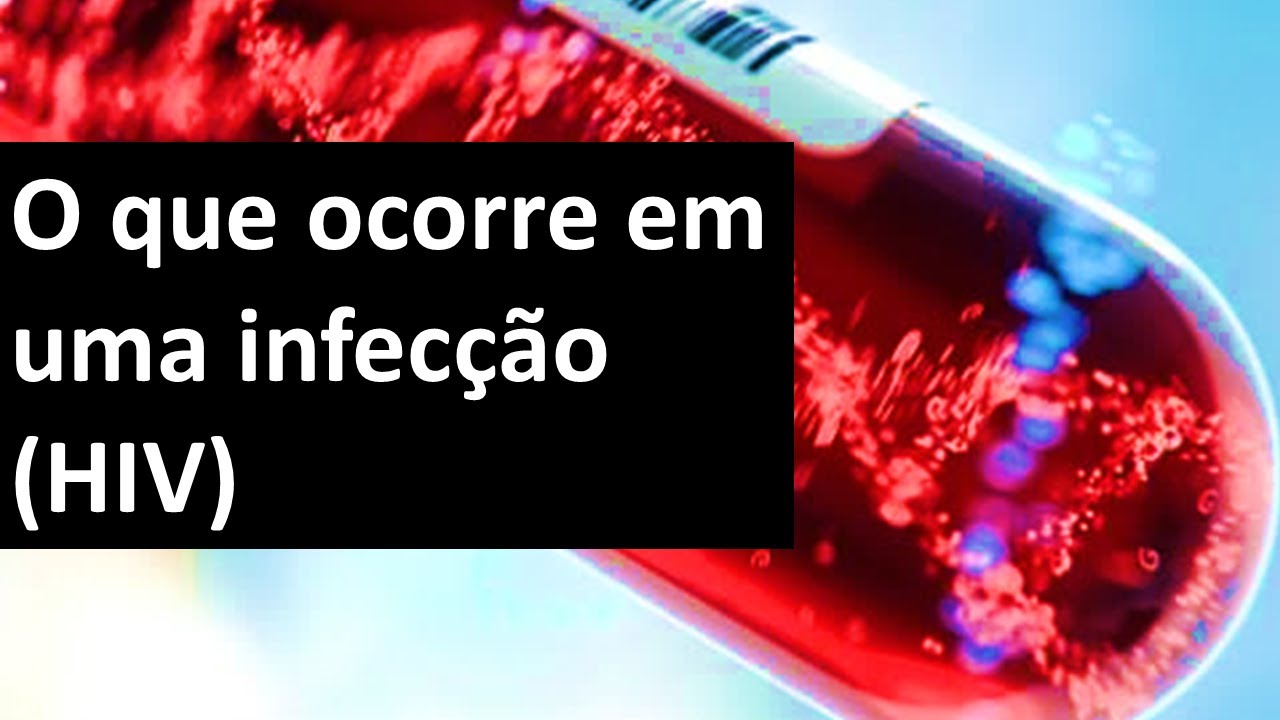 O que ocorre em uma infecção (HIV) | Odontologia | Dra Bianca Rosa ...