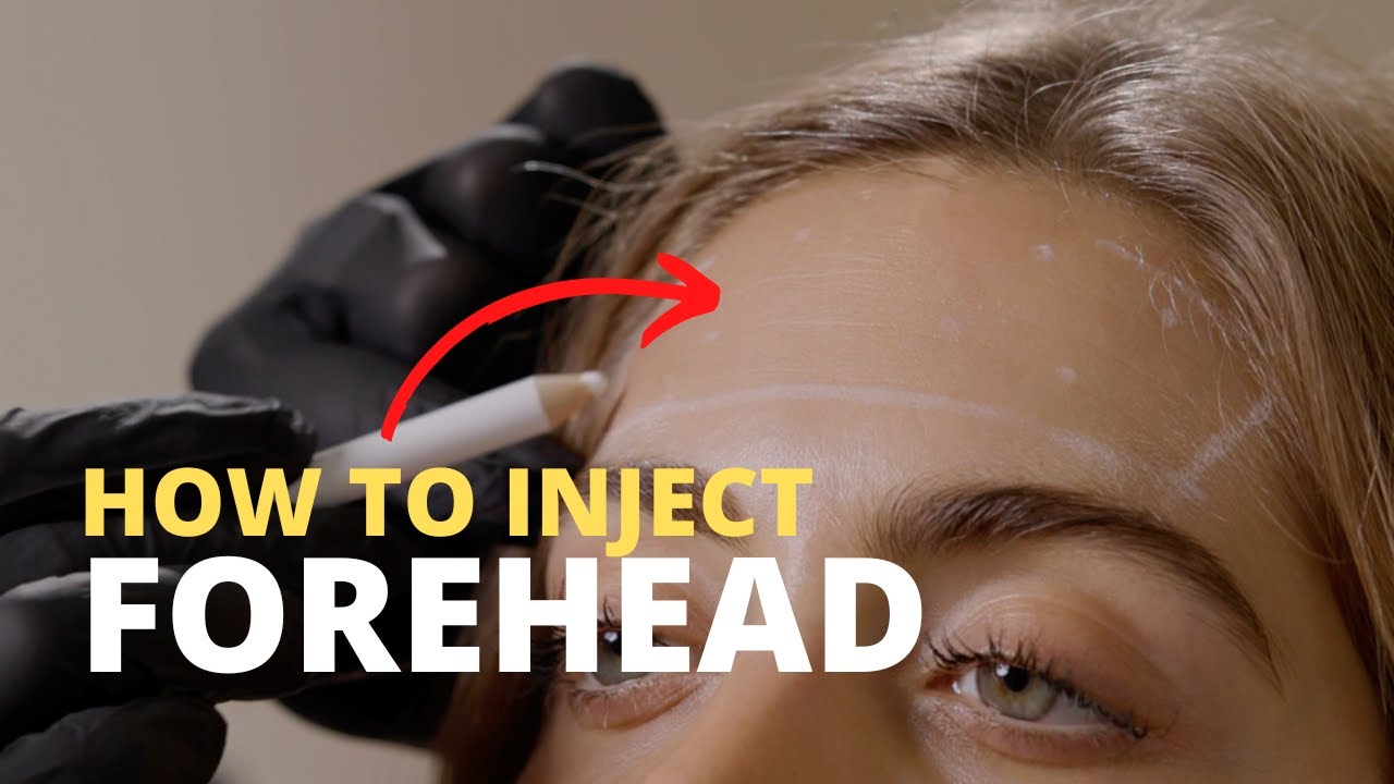The most RELIABLE forehead injection technique - YouTube