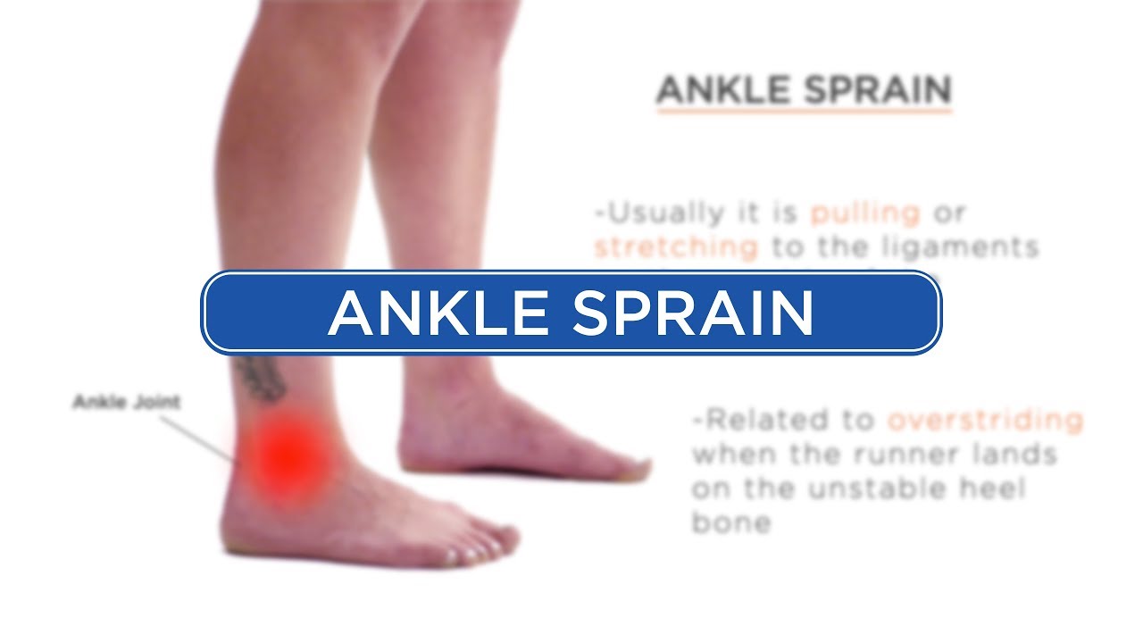 Ankle Sprain - Diagnosis - YouTube