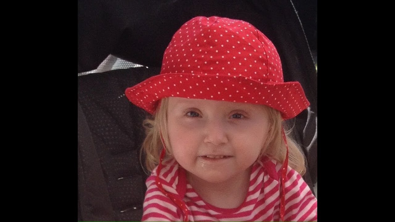 Trisomy 9 Mosaic - YouTube