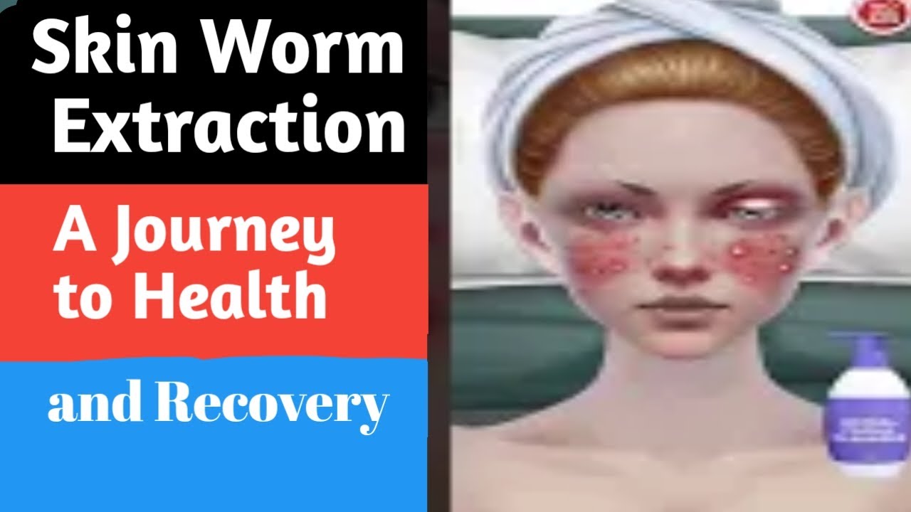 Skin Worm Extraction: A Journey to Health and Recovery # ...