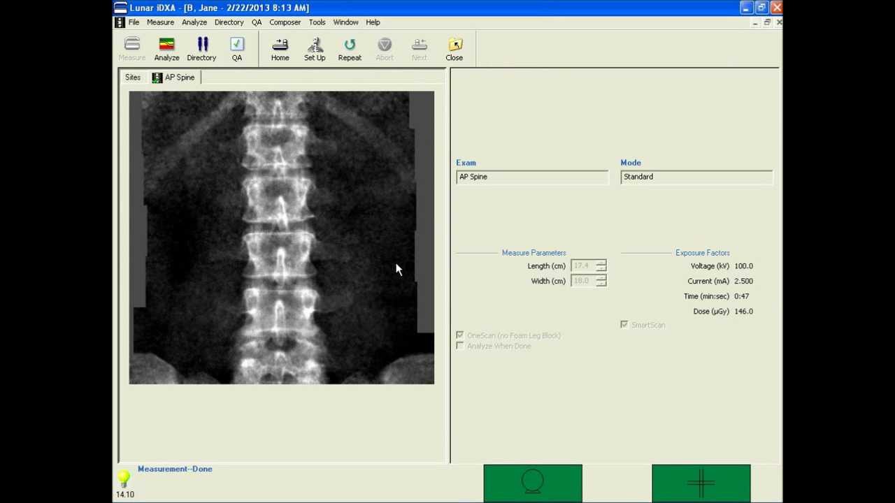 TBS in your clinical practice with GE Lunar DXA - YouTube