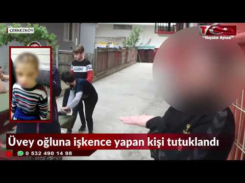 Üvey oğluna işkence yapan kişi tutuklandı