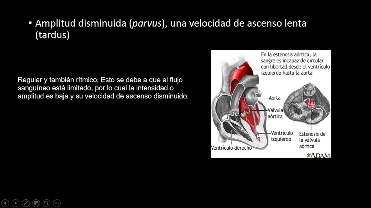Pulso Parvus Et Tardus - RETOEDU