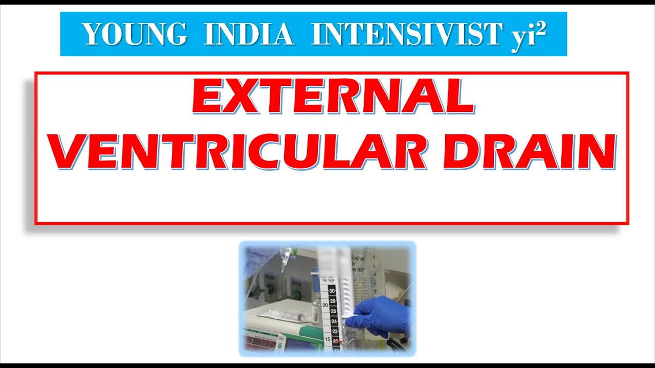 EXTERNAL VENTRICULAR DRAIN EVD ( courtesy nejm ) - YouTube