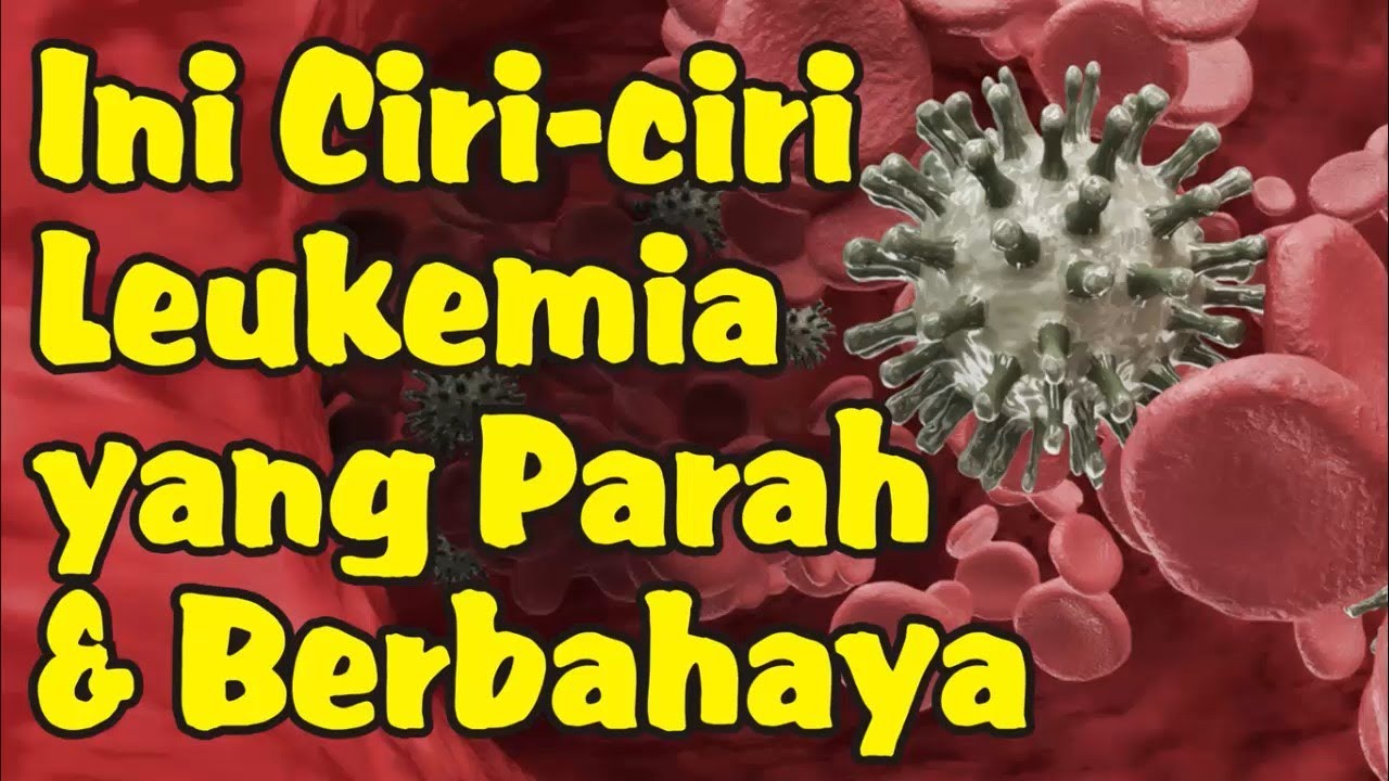 Ciri-ciri Leukemia yang Sudah Parah dan Berbahaya - YouTube