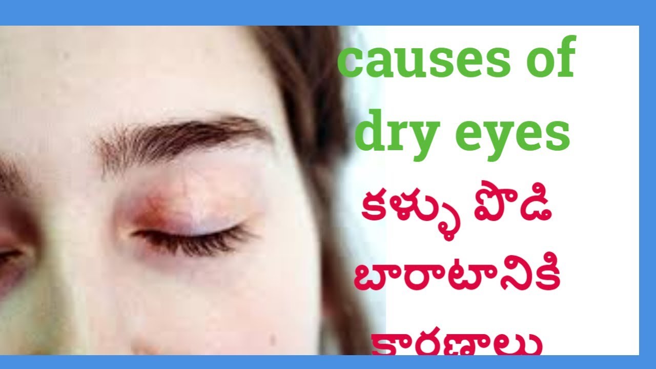 causes of dry eyes| symptoms of dry eyes in telugu| పొడిగా అవ్వటానికి ...