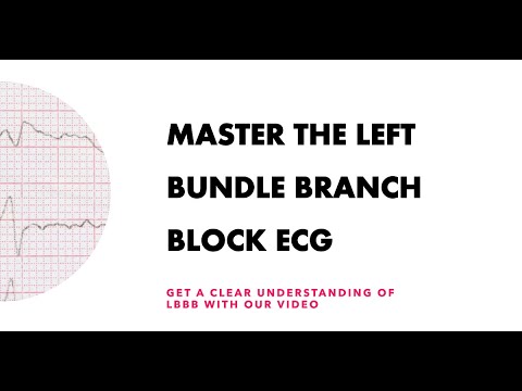 Master the Left Bundle Branch Block ECG: Get a clear understanding of ...