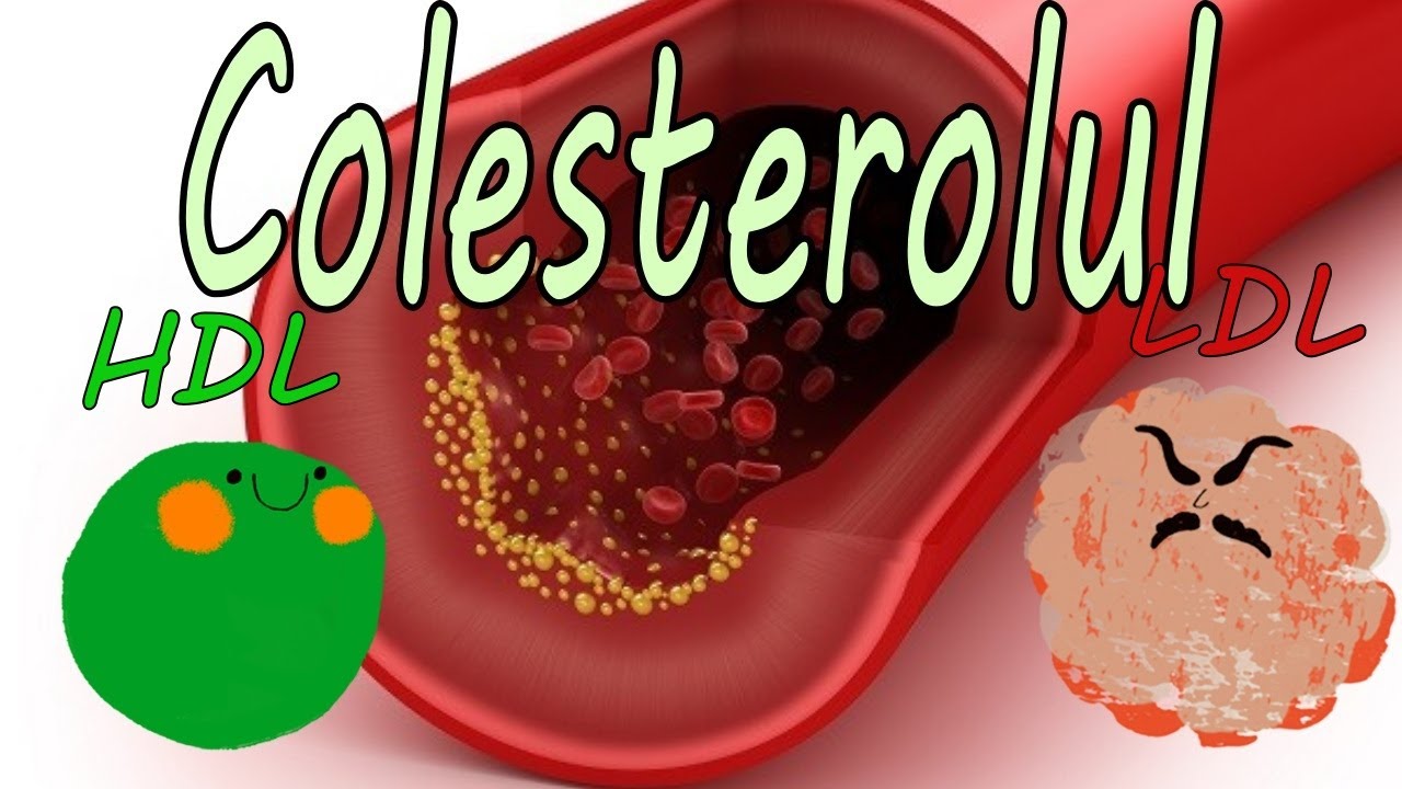 7. Colesterolul - Dr. Emil Radulescu - YouTube