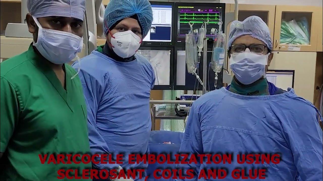 Varicocele Embolization Using Sclerosant Coils And Glue Youtube