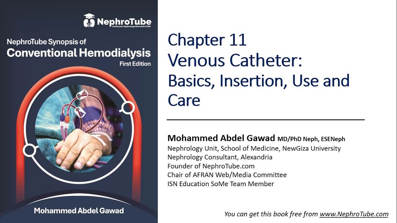 Hemodialysis: Chapter 11, Venous Catheter: Basics, Insertion, Use ...