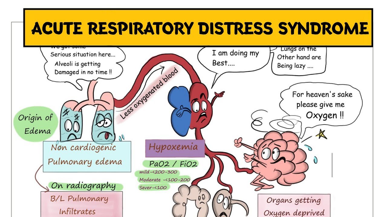 Lecture 24: ARDS ,OSA | RESPIRATORY PATHOLOGY | FIRST AID USMLE STEP 1 ...