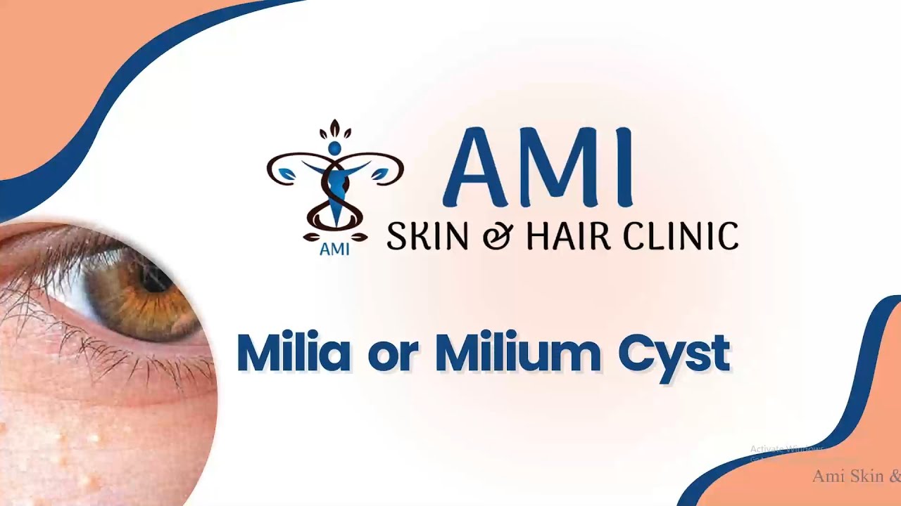 Milia or Milium Cysts | Laser & Chemical Peel | AMI Skin & Hair Clinic ...