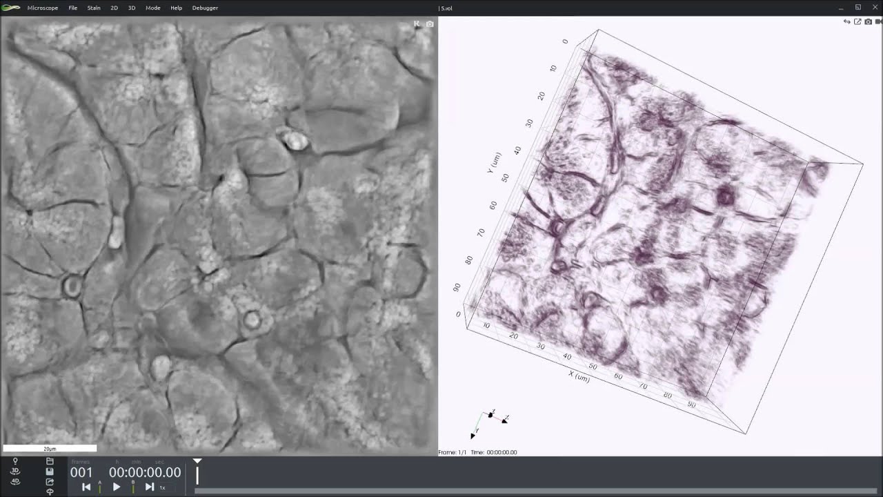 Section of mouse pancreas tissue - YouTube