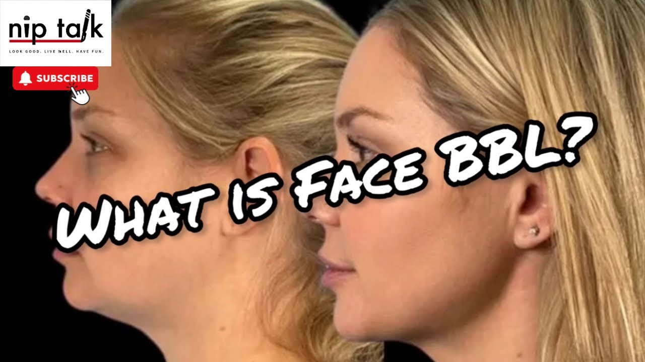 Face BBL Explained: Is This The Newest Facial Rejuvenation Trend? - YouTube