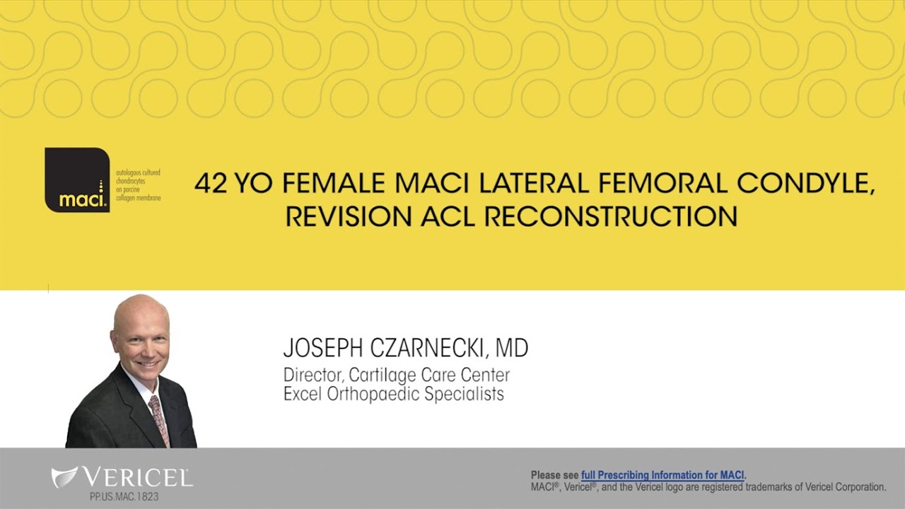 Joseph Czarnecki, MD performs the MACI procedure with ACL ...
