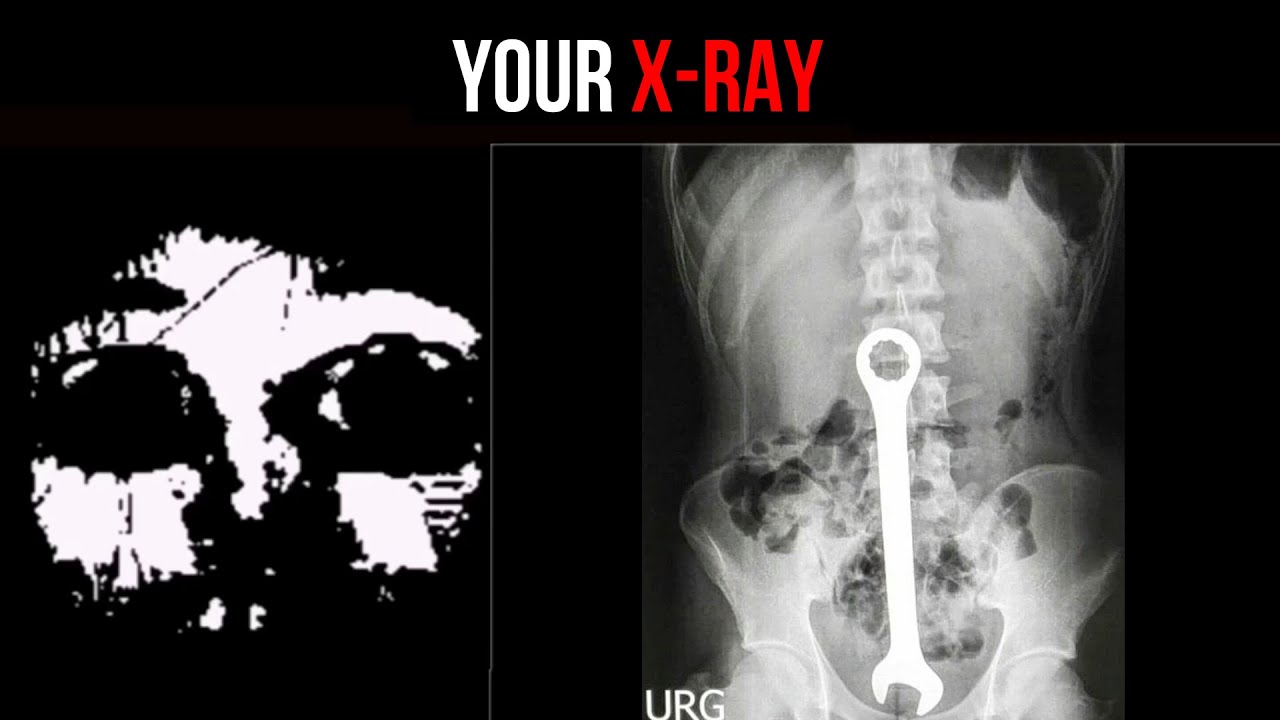 Mr Incredible Becoming Uncanny (X-ray) - YouTube