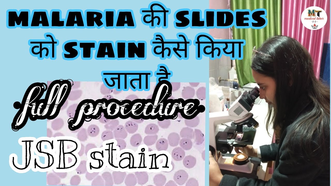 malaria की slides को कैसे stain किया जाता है full procedure #malaria # ...