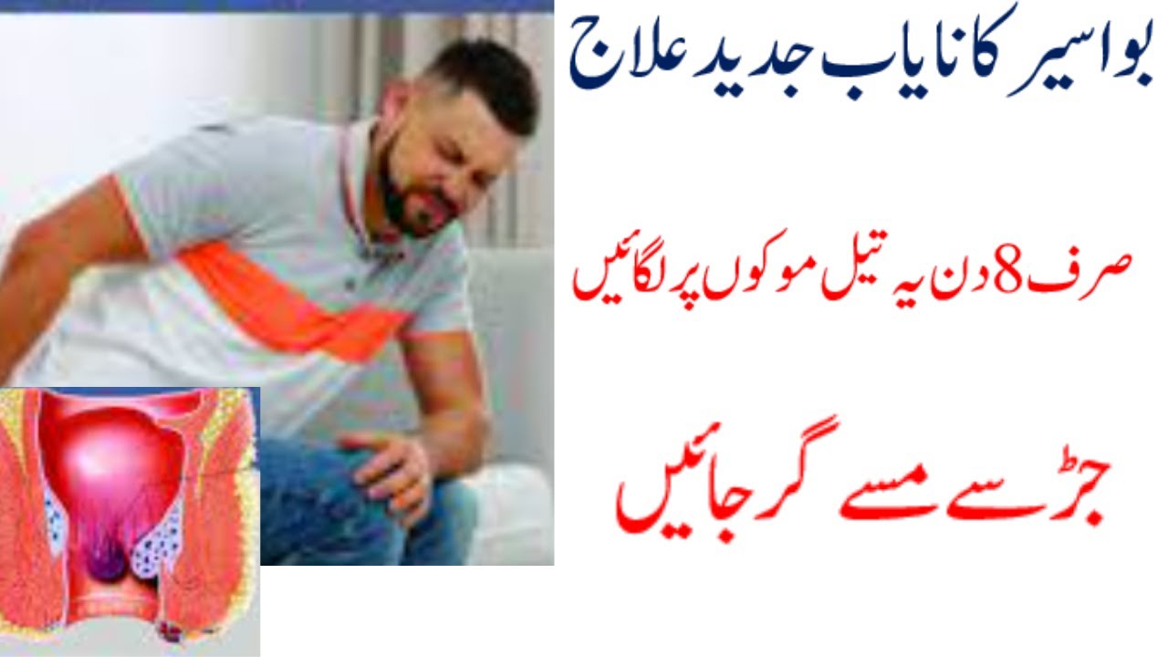 Bawaseer ka ilaj / بواسیر کا علاج - YouTube