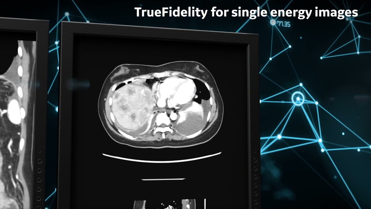 What's New with CT at GE Healthcare? - YouTube