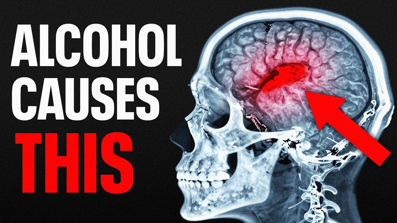 What Alcohol Really Does To Your Brain (NEW Science Revealed) - YouTube
