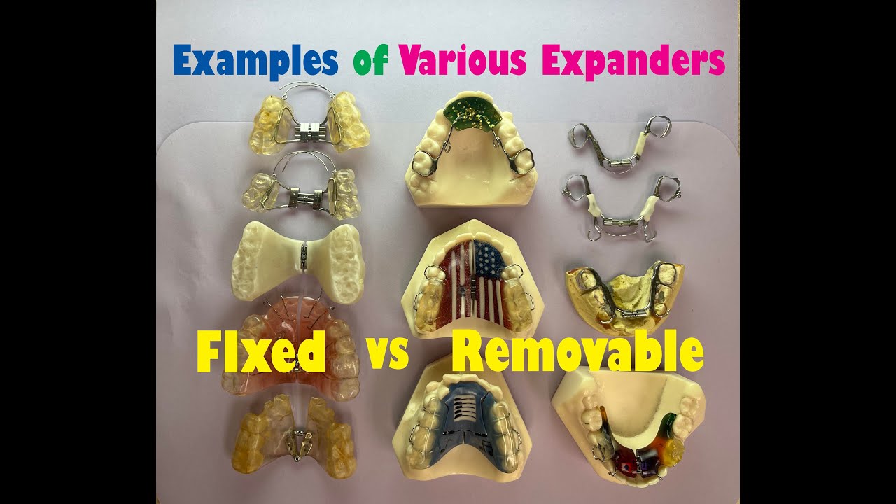 How to turn / adjust the screw of a Dental Orthodontic Expander (如何轉動 ...