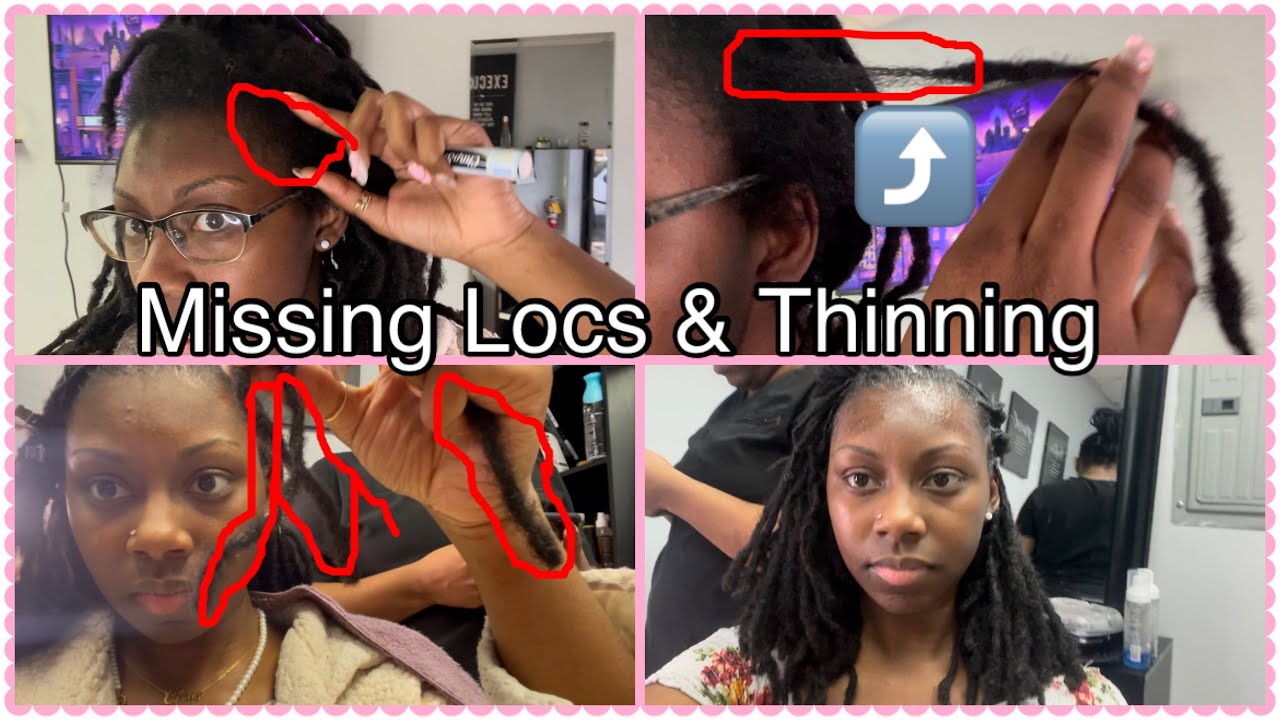 My Instant Locs are FALLING OUT 😳 | Instant Loc Journey | I wish knew ...