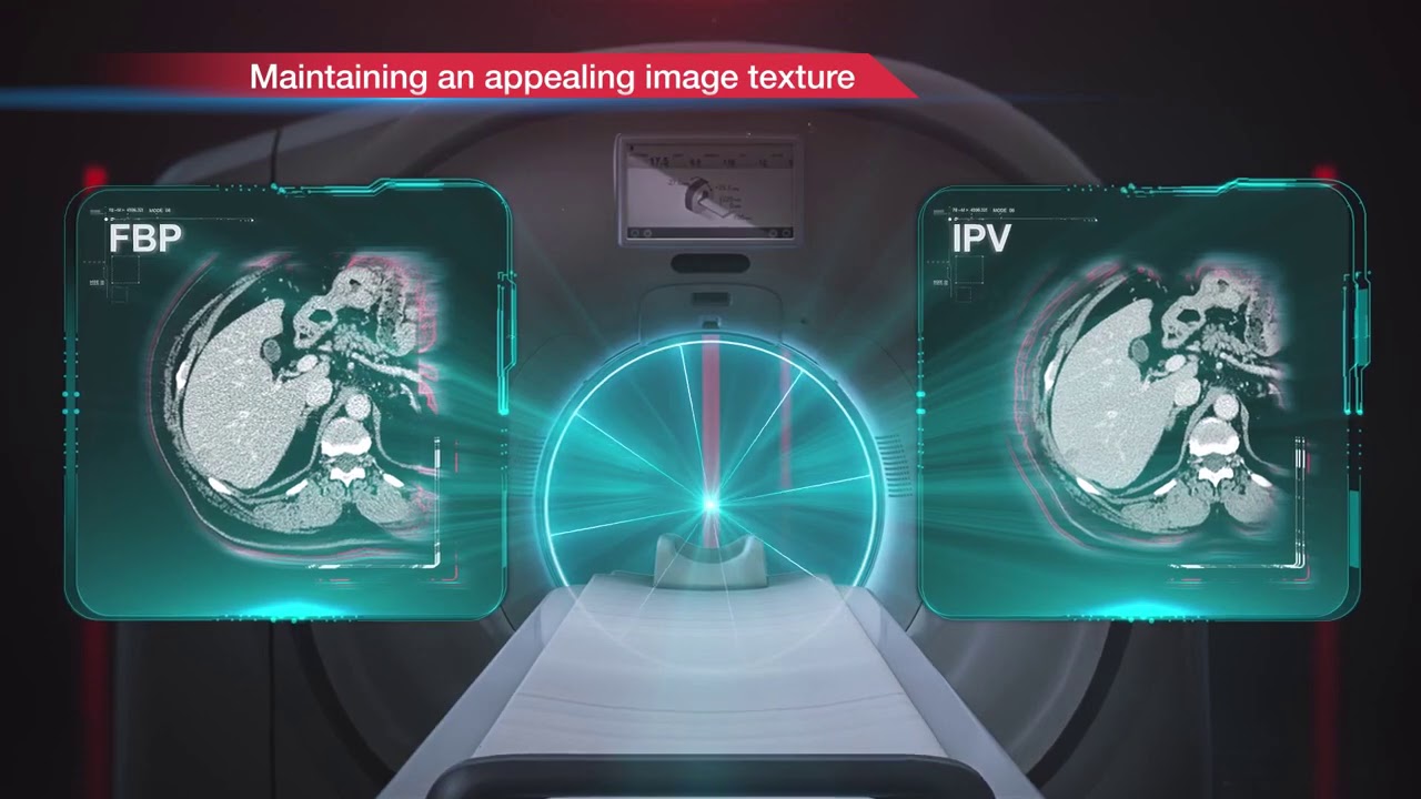 Hitachi SCENARIA View 128 slice CT Scanner - YouTube