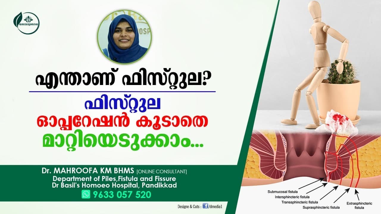ഫിസ്റ്റുല ഓപ്പറേഷൻ കൂടാതെ മാറ്റിയെടുക്കാം | Fistula Malayalam | Dr ...