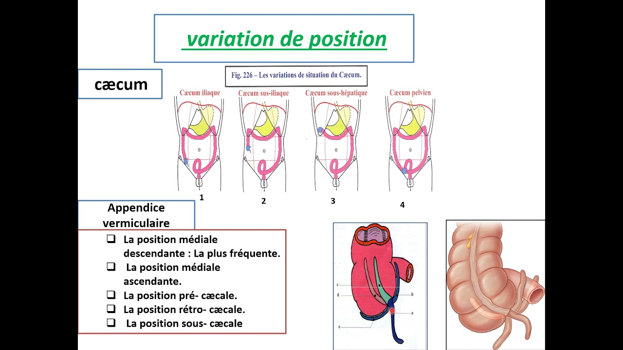 ANATOMIE DU COLON - YouTube