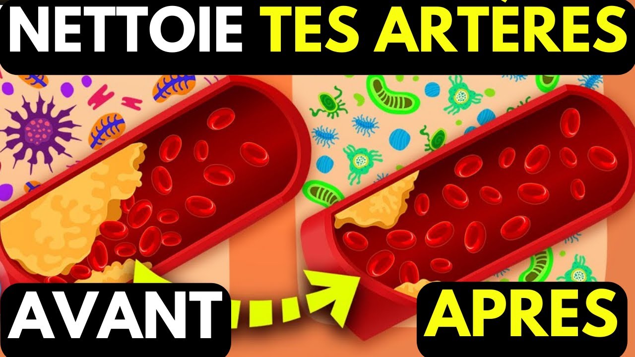 Les Aliments et méthodes Magiques pour Déboucher Vos Artères - YouTube