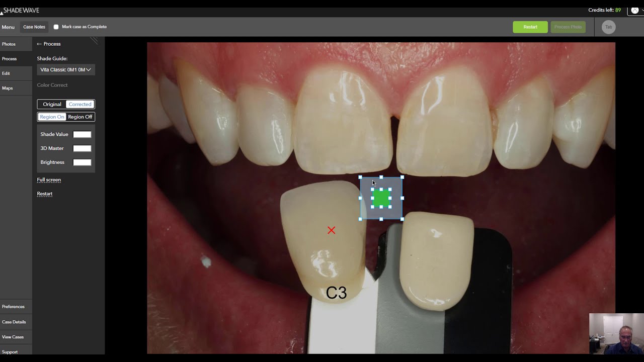 02 ShadeWave 2.0: Process Case (short version) How to Get the Tooth ...