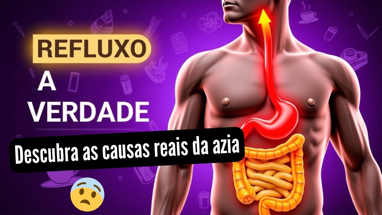 Descubra os Mistérios do Refluxo Gastroesofágico: O Que Realmente ...